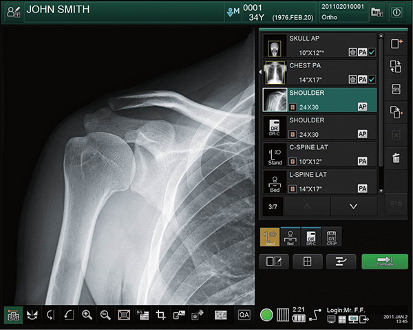 FDX Console Workstation Acquisition Shoulder – Advanced Medical X-ray