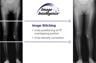 Fuji Long View Cassettes – Advanced Medical X-ray
