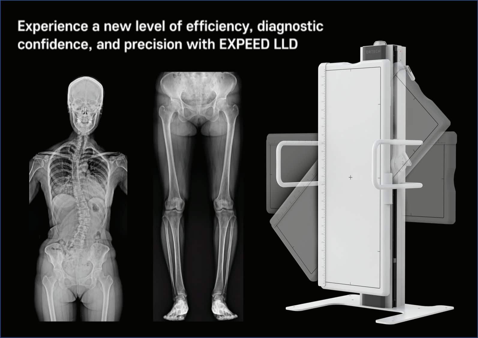 EXPEED Long-length DR Imaging System – Advanced Medical X-ray